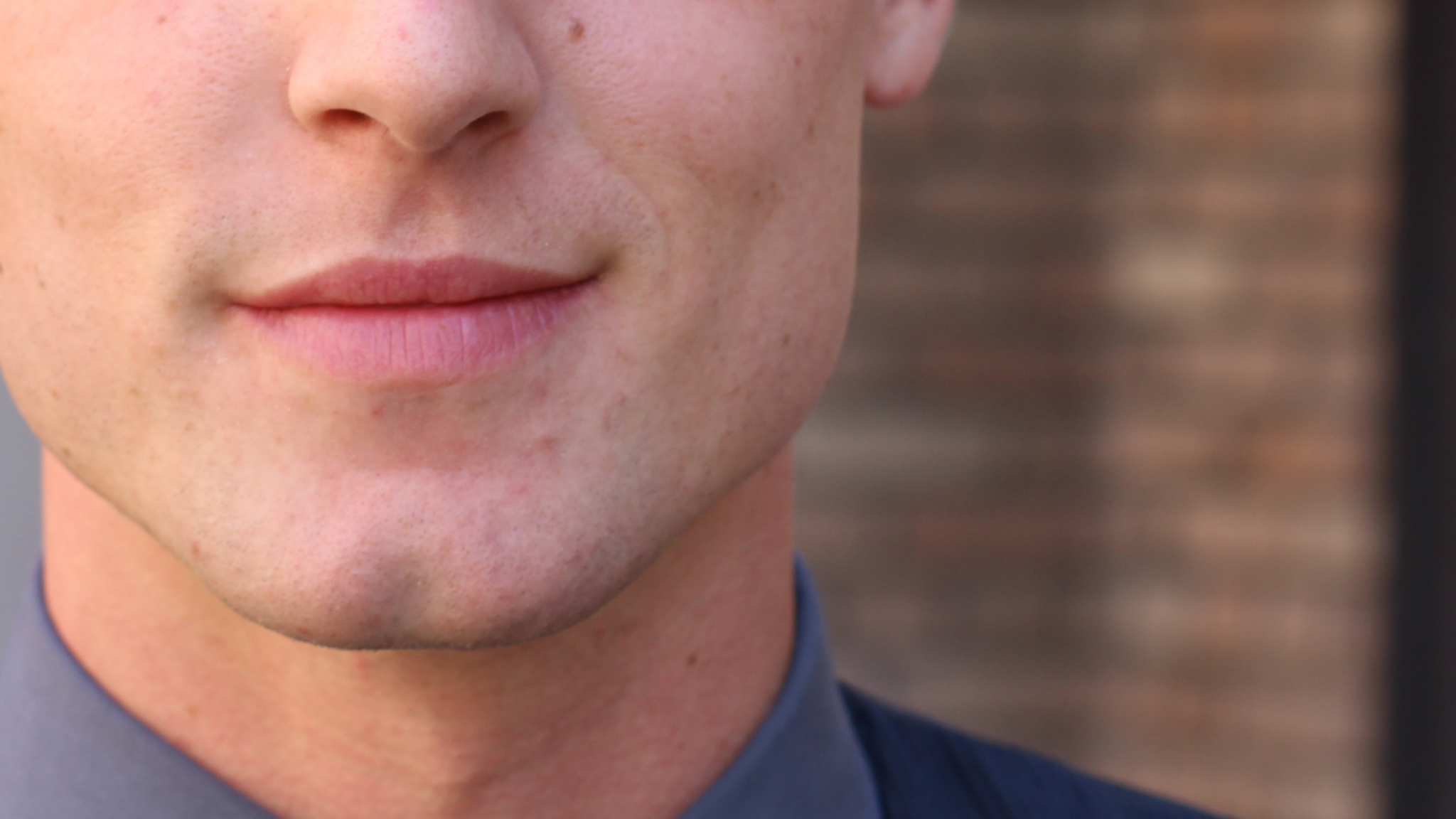 Contouring the lower face with dermal fillers - Dr Liesel Holler